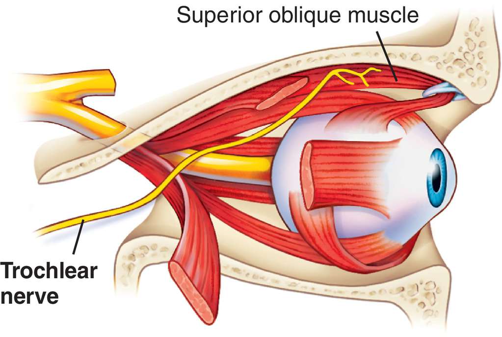Trochlear Nerve