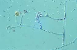 Absidia | definition of Absidia by Medical dictionary