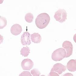 Cabot rings | definition of Cabot rings by Medical dictionary