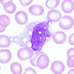 Monocyte | definition of monocyte by Medical dictionary