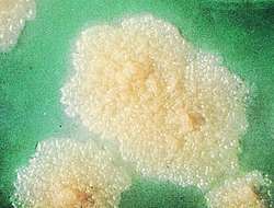 Mycobacterium | definition of Mycobacterium by Medical dictionary