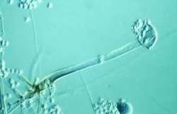 Rhizopus | definition of Rhizopus by Medical dictionary