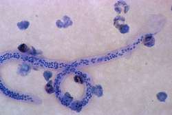 Wuchereria | definition of Wuchereria by Medical dictionary