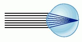 Emmetropia Treatment