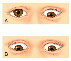 Conjugate Eye Movement