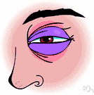 Shiner - definition of shiner by The Free Dictionary